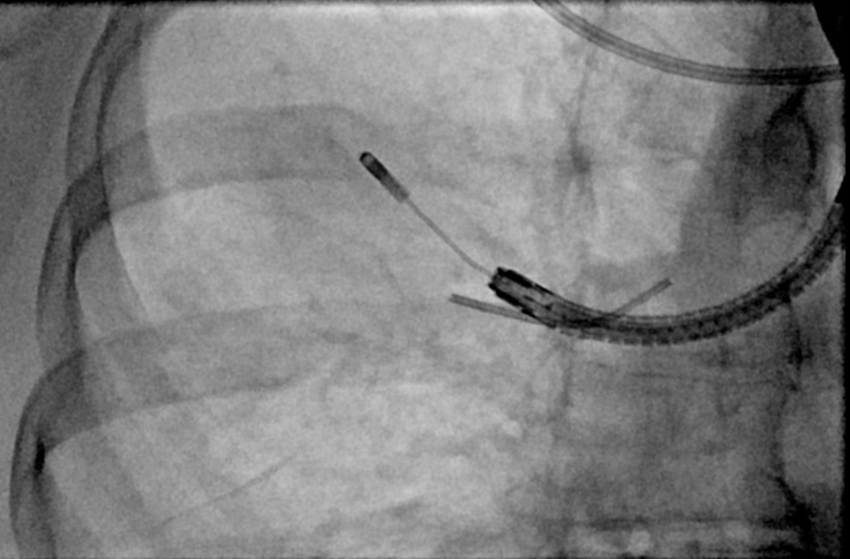 American Thoracic Society - Best of ATS Video Lecture Series